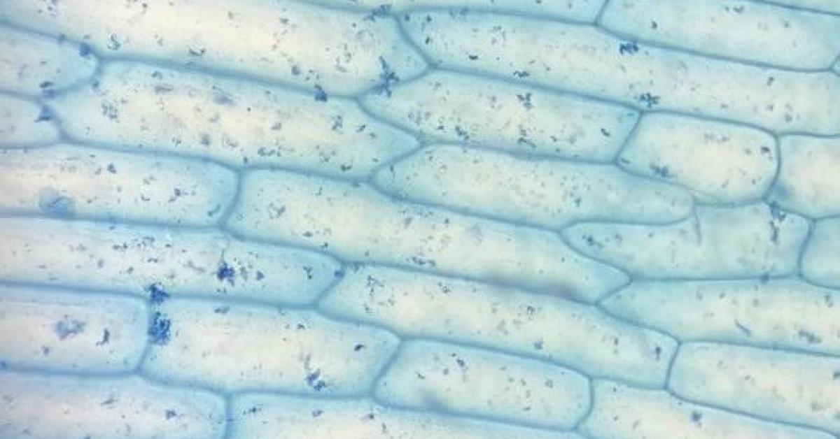 Celulas De Cebola